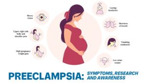Understanding Preeclampsia: Symptoms, Research and Awareness – The Mom ...