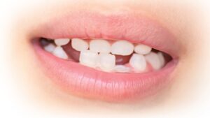 The Tooth is… Baby Teeth are Important! – The Mom & Caregiver